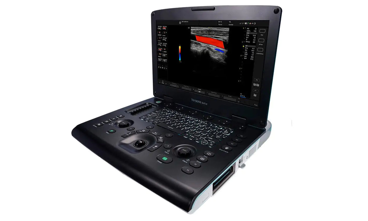 Ultrasound device Versana Active – Animal IVF Store